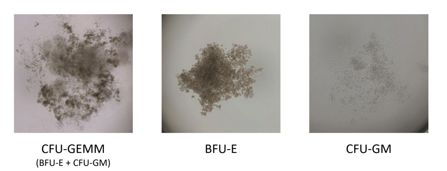 コロニー形成ユニット（CFU）アッセイ ～造血幹細胞の機能性を評価する～ - ネクスジェン株式会社